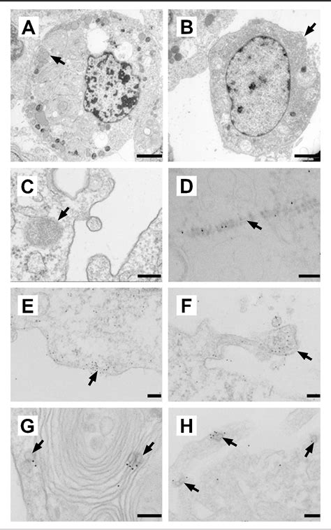 Figure 1 From Experimental Infection Of Tick Cells With Nipah Virus Semantic Scholar