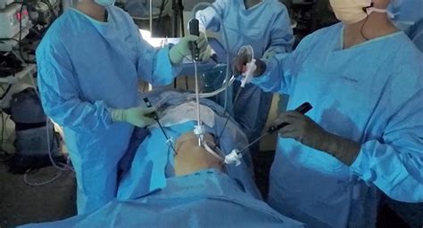 Thoracoscopy For Minimally Invasive Esophagectomy Using Three Thoracic