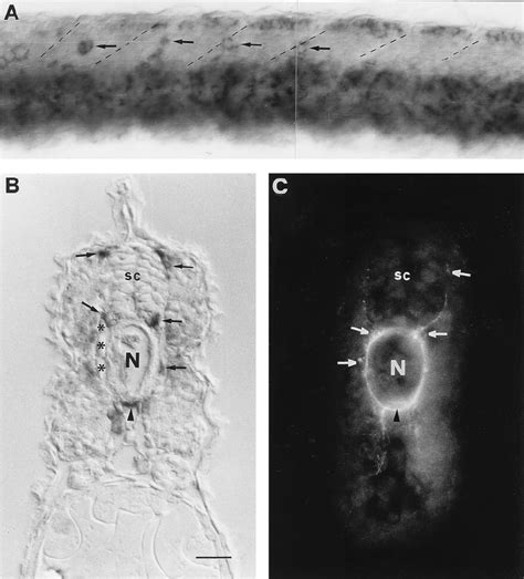 Distribution Of Tn C Mrna By In Situ Hybridization In Trunk Neural