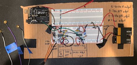 Alex Hadidi Mini Ecg