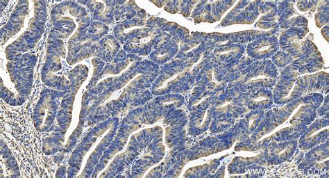 Rps3 Antibody 84947 4 Rr Proteintech
