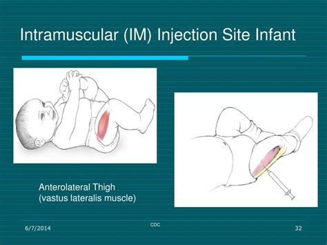 Ppt Massachusetts Department Of Public Health Training Module