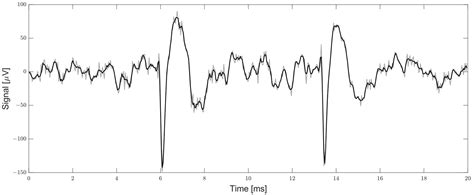 Fpga Design Integration Of A 32 Microelectrodes Low Latency Spike