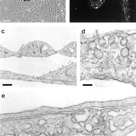 Coculture Of Ace Cells With Isolated Choroid Plexus Epithelial Cells