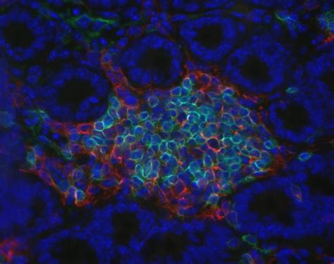 Projects Newberry Lab Washington University In St Louis