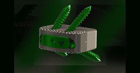 Vyspine Granted Fda Clearance For Lumivy Lumbar Interbody Fusion