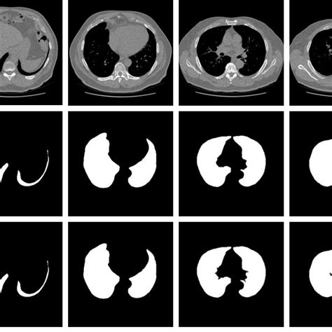 Segmentation Results Of The Proposed Method On Lung Dataset The Download Scientific Diagram