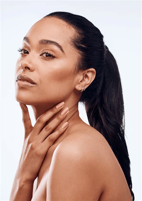 Melasma Treatment Ncbc Med Laser Ltd