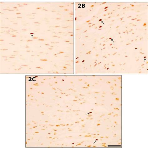 Tunel Detection Of Apoptotic Cells In Control A Dox Treated B And Download Scientific