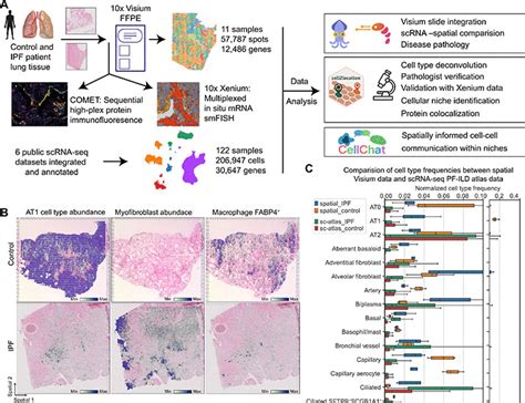 Spatial Transcriptomic Characterization Of Pathologic Niches In Ipf Domenico Lazzaro