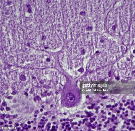 Purkinje Cells Histology