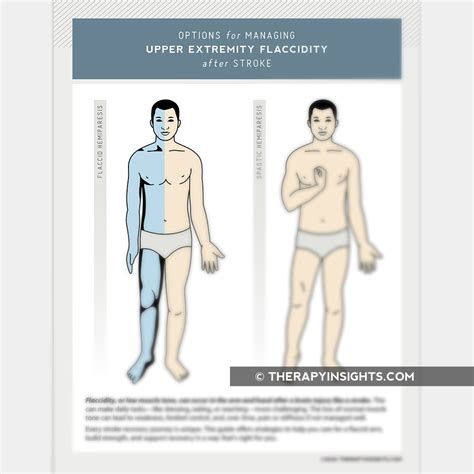 Options For Managing Upper Extremity Flaccidity After Stroke Adult