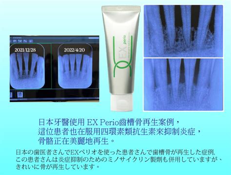 YOZAI悠哉美健 日本先進牙周病對策與關健保養的提供者 關健 口腔保健