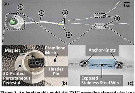 Figure 1 From Edge Ai Based Closed Loop Peripheral Nerve Stimulation System For Gait