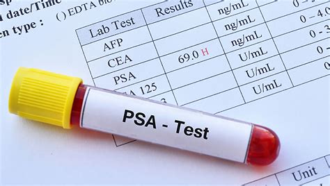 Prostate Specific Antigen Psa Test Bangkok Hospital Phuket International Hospitals In Thailand