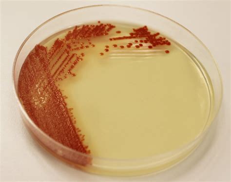 Environmental Isolate Case Files Serratia Marcescens Microbiologics Blog