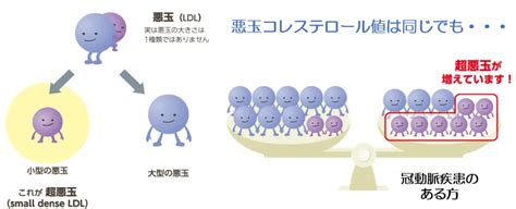 超悪玉コレステロール検査｜健康診断｜新潟ウェルネス