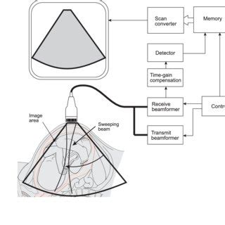 7 Elevation Focused Convex Array Transducer For Obtaining A Download Scientific Diagram