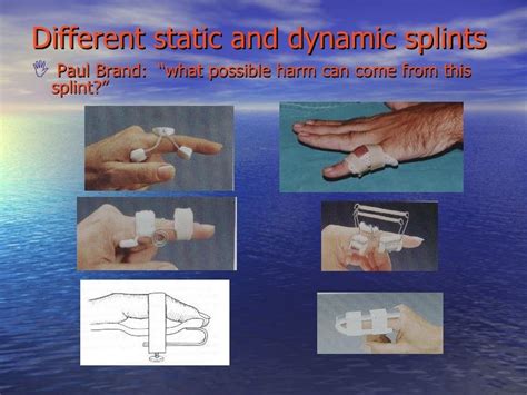dynamic cast vs static cast