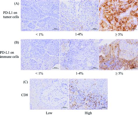 Immunohistochemical Ihc Staining Patterns For Programmed Death Ligand