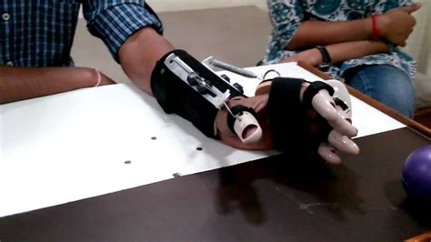 Dynamic Hand Splint
