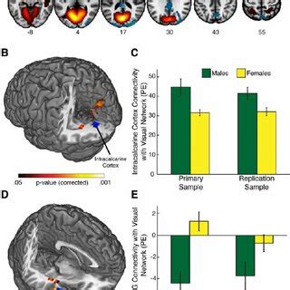 Bidirectional Sex Differences In Connectivity With Auditory RSN Download Scientific Diagram