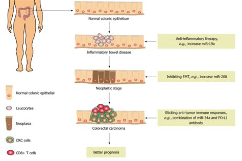 Mirna Based Immunotherapy In Multi Steps Colorectal Carcinoma Download Scientific Diagram
