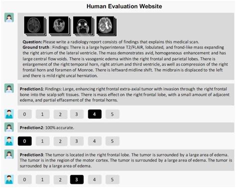 全球首个开源多模态医疗基础模型：人工打分平均超越gpt 4v、支持2d 3d放射影像 澎湃号·湃客 澎湃新闻 The Paper