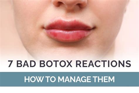 7 Bad Botox Reactions And How To Manage Them