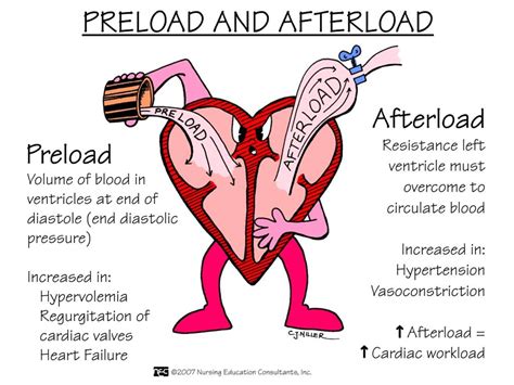 Nursing Mnemonics Preload Vs Afterload Studypk