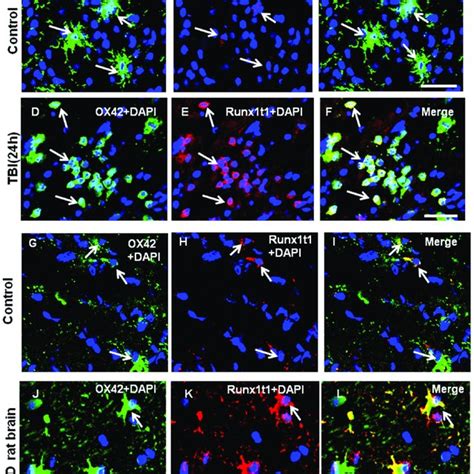 runx1t1 protein expression in the activated microglial cells of tbi and