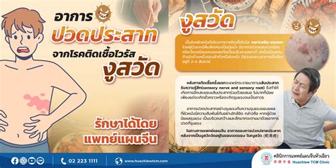 อาการปวดประสาทจากโรคติดเชื้อไวรัส งูสวัด รักษาได้โดยแพทย์แผนจีน Thaipr Net