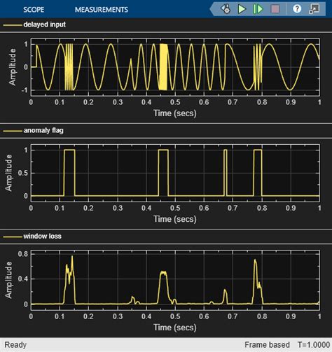 Deep Signal Anomaly Detector
