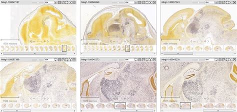 Api For Allen Developing Mouse Brain Atlas Allen Developing Mouse Brain Atlas Allen Brain