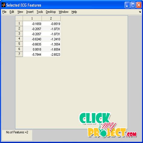 Optimization Of Ecg Classification By Means Of Feature Selection