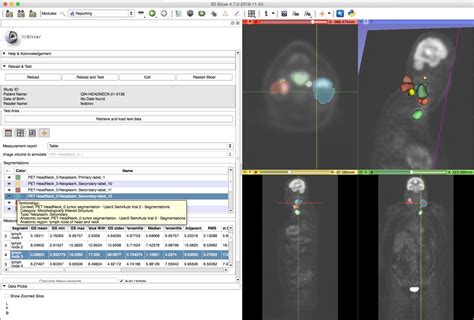 3d Slicer Dicom4qi