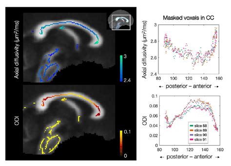 Variations In The Intra Axonal Axial Diffusivity Top And Fibre Download Scientific Diagram