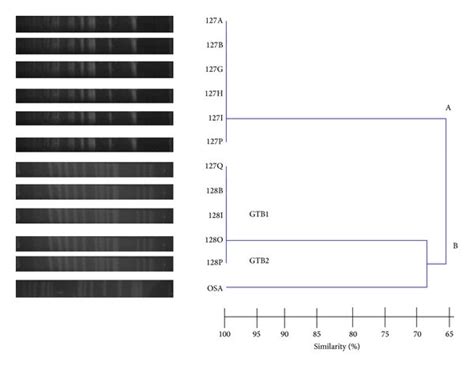 Fingerprints And Dendrogram Obtained By Pfge Of Twelve Salmonella