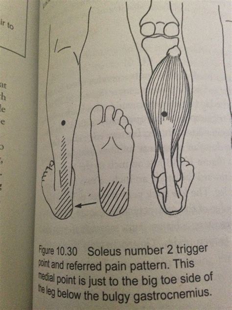 Trigger Point Work For Psoas Minor Pecs Lower Calves Lower Back Glutes Backs Of Knees