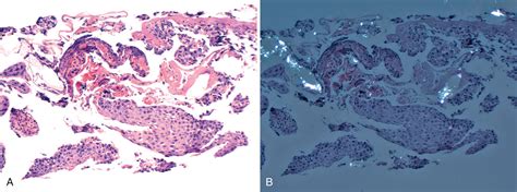 Drug Induced Disorders Of The Gastrointestinal Tract Clinical Tree
