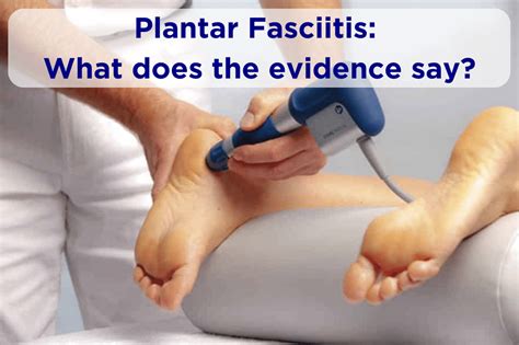 Plantar Fasciitis Evidence Based Insights Leading Edge Podiatry