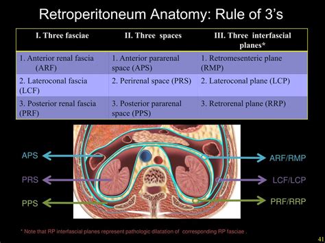 Retroperitoneal Masses Radiology