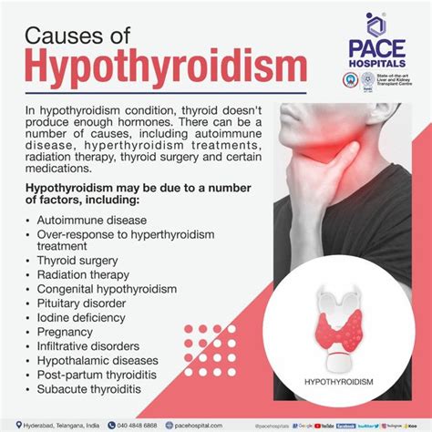 Causes Congenital Hypothyroidism