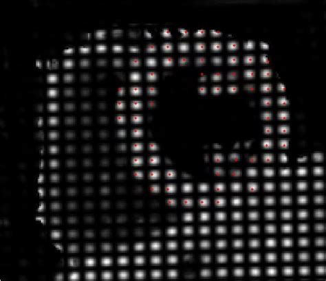 Figure 1 From Motion Estimation Of Tagged Cardiac Magnetic Resonance