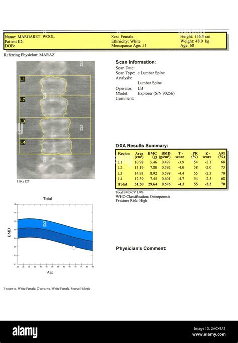 Dual Energy X Ray Absorptiometry Dexa Scan Of A 68 Year Old Female Patients Lumbar Spine
