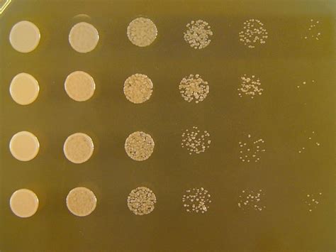 Response Of Pathogenic Yeast Cryptococcus Neoformans To Hypoxia Palacký University Olomouc