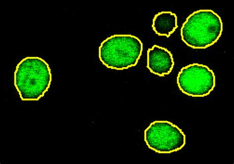 Sample Image Of Segmented Scerevisaie Yeast Cells In Two Overlaid