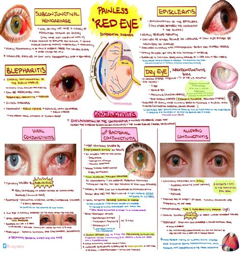 Causes Of Red Sclera