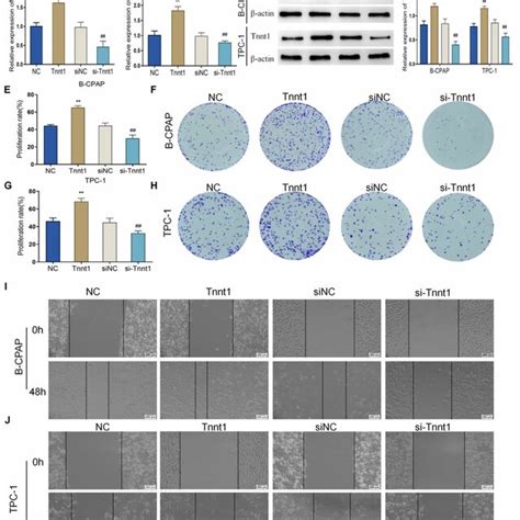 Tnnt1 Promotes The Proliferation And Migration Of Papillary Thyroid