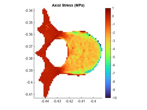 Medical Image Based Finite Element Analysis Of Spine MATLAB Simulink